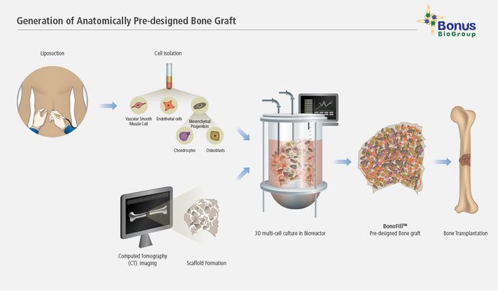 In World First, Israeli Biomedical Group Successfully Transplants Lab ...