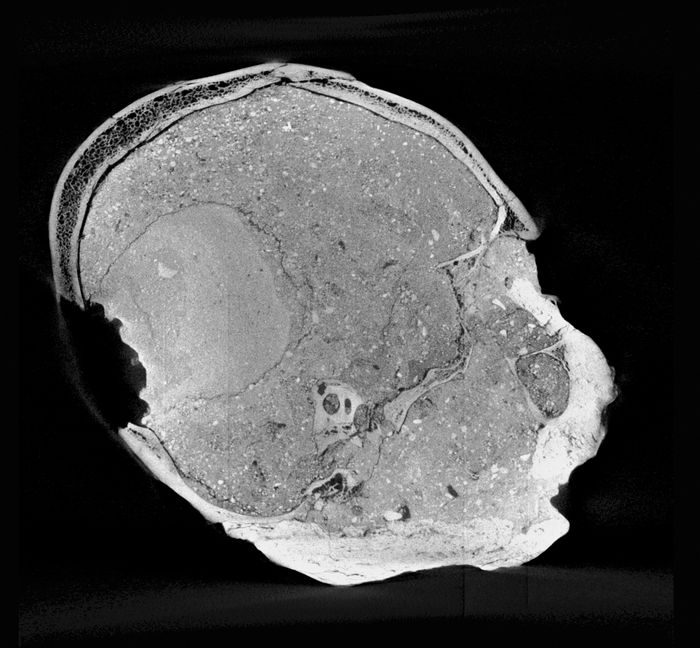 Mysteries Of The Jericho Skull: Face Of 9,500-year-old Man ...