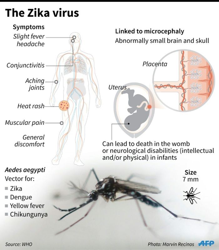 Texas Reports Case Of Sexually Transmitted Zika Virus: Official - i24NEWS
