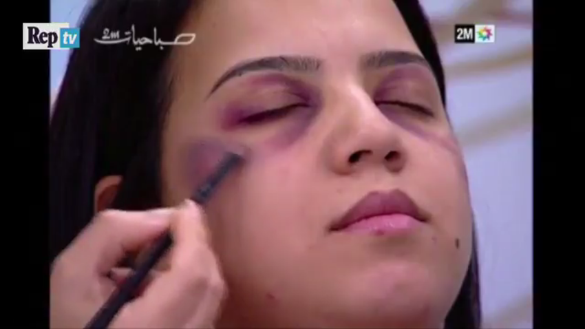 Se Makeup Bruises - Mugeek Vidalondon