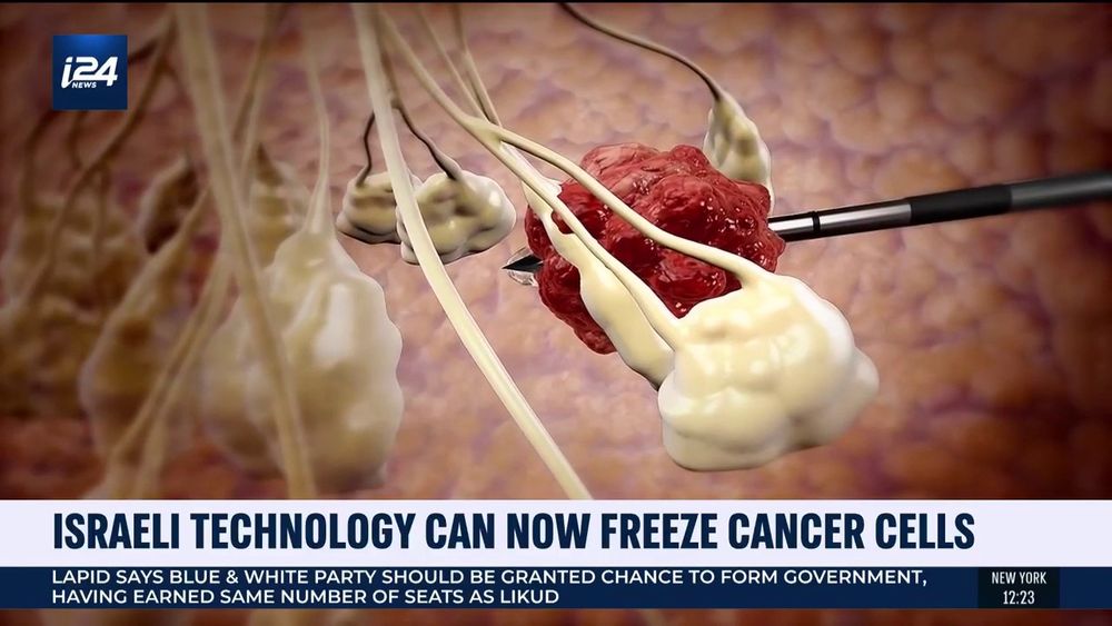 New Israel Technology Can Now Freeze Cancer Cells - i24NEWS